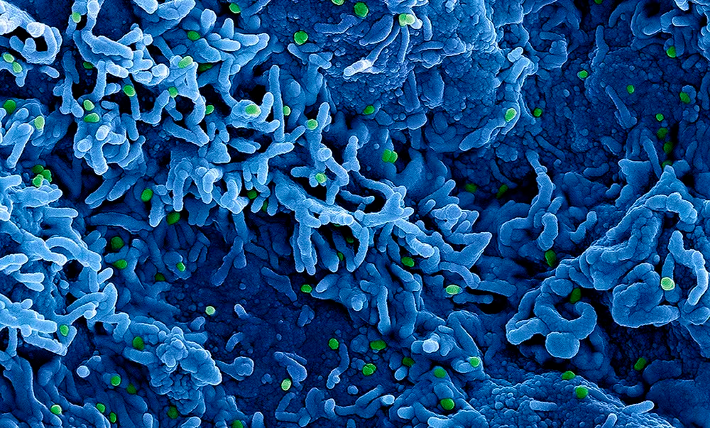 INFOGRÁFICOS explicam como é o vírus da mpox, um dos maiores e mais ...